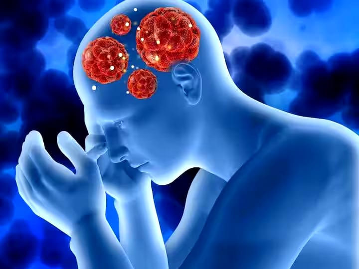 These are the reasons why brain tumors can occur, know