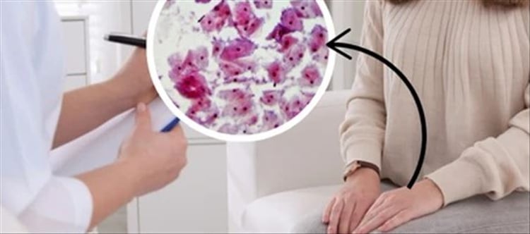 Most Common Vàginal Infection May Actually Be An STD - Study