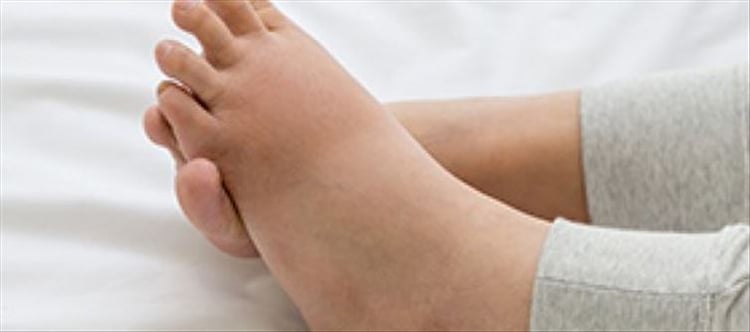 3 symptoms of high uric acid signs