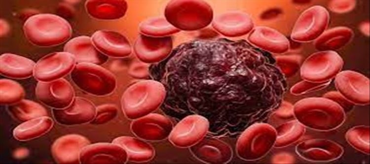 Blood Cancers: The Battle Against Abnormal Blood Cells.
