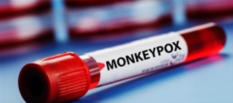 How Does Monkeypox Spread? Scientific Facts