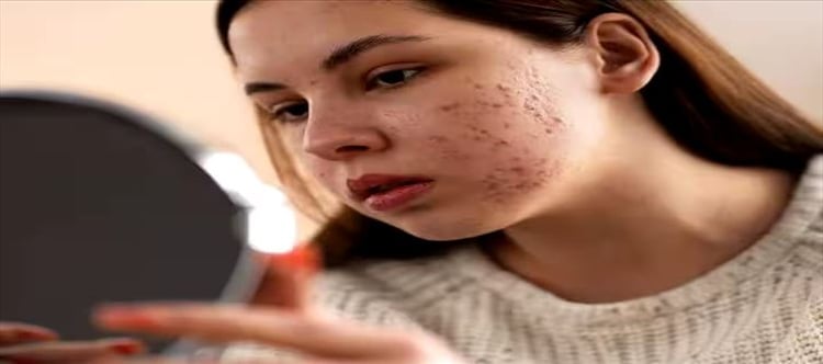 What causes the red dots on the body?