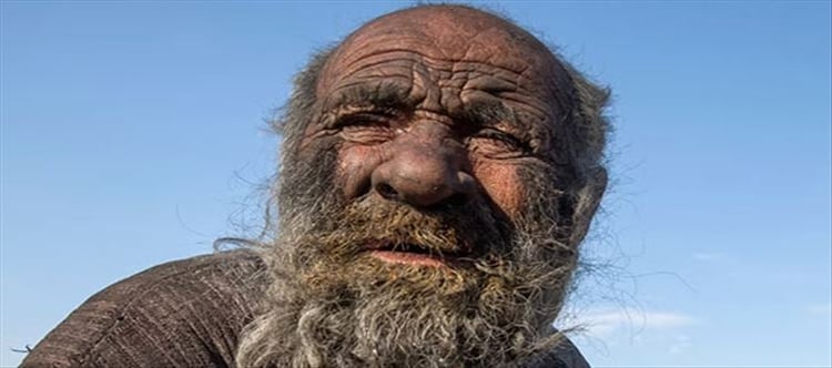 World s dirtiest man died after taking a bath