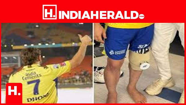 Dhoni has a leg problem.. ? Doctor s Warning..