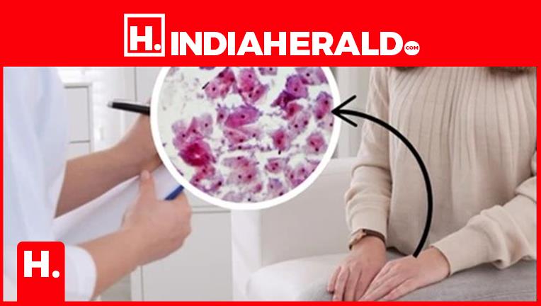 Most Common Vàginal Infection May Actually Be An STD - Study
