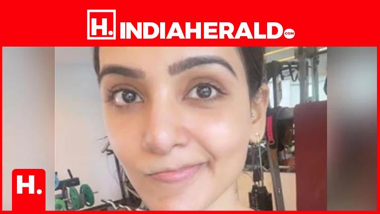 Samantha ‘misleading’ 33 million followers says Doctor Samantha ‘misleading’ 33 million followers says Doctor