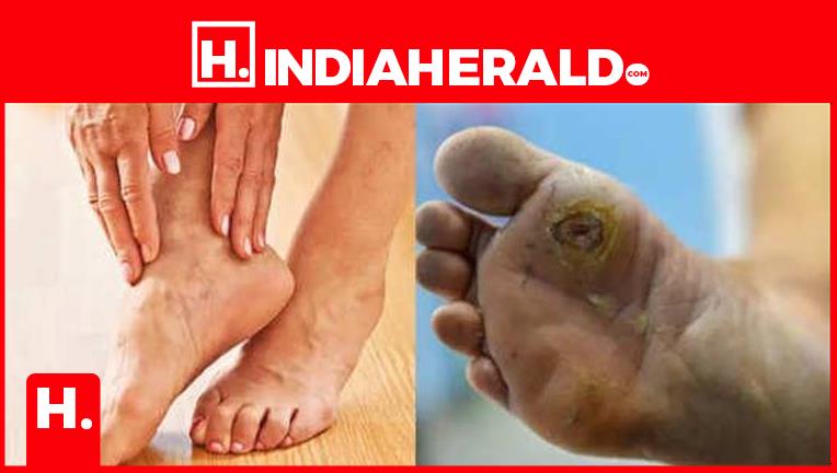 Take a Closer Look At Your Feet - These Are WARNING SIGNS