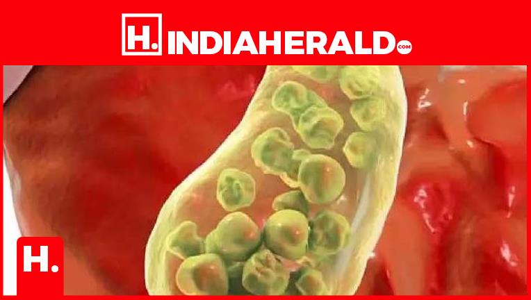 These Foods Turn Into Stones As Soon As You Eat Them - BEWA