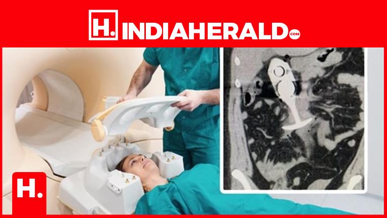 Woman Left Screaming In Pain After Séx Toy Pulled Through
