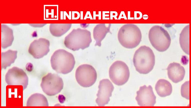 The world s most expensive drug in market