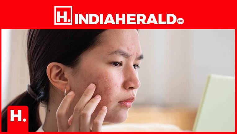 A Way To Reduce The Arrival Of Scars: Expert Pointers