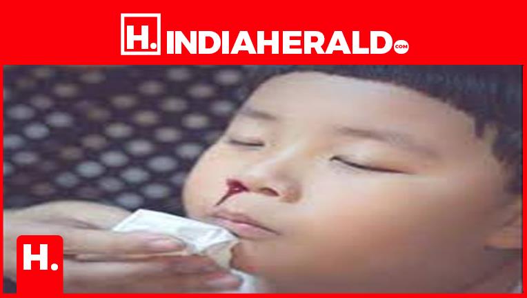 Attention parents.. Children s nose bleeding? Don t ignore