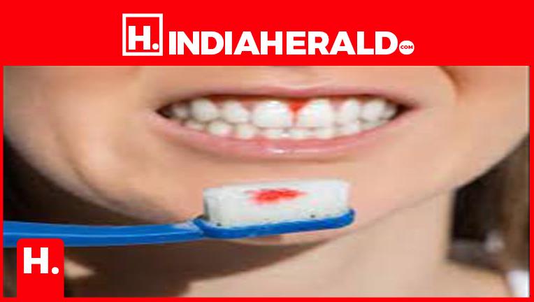 Bleeding while brushing your teeth? This may be the problem