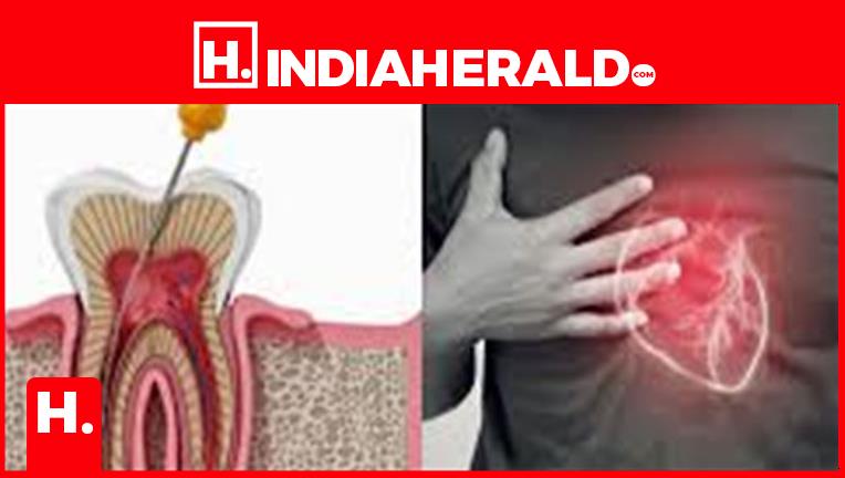 Can A Root Canal Motive A Heart Attack?