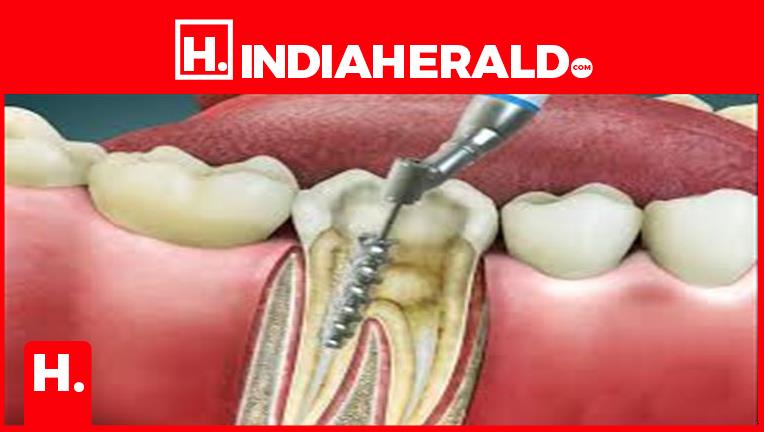 Can root canal treatment of teeth be cause of heart attack?