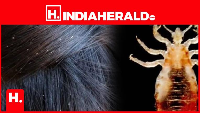 “How a Simple Lice Bite Turned Fatal: Odisha Girl’s Shockin