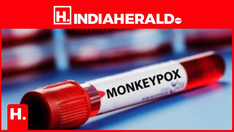 How Does Monkeypox Spread? Scientific Facts
