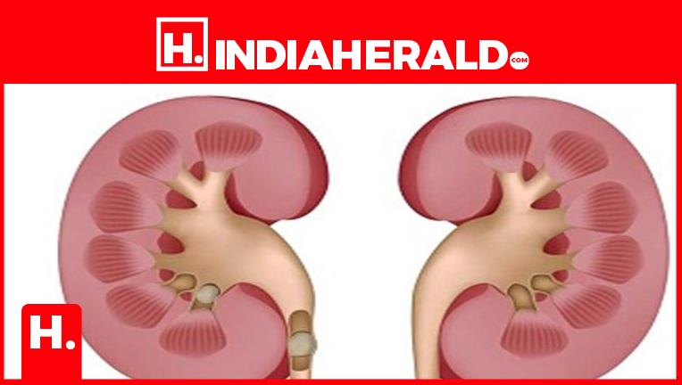 Kidney damage Sign: These signs seen on the body along with