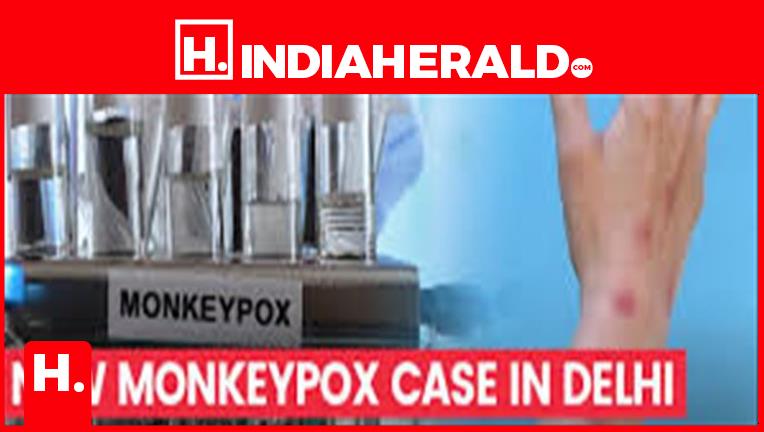 Monkeypox: 3 more people confirmed infected in Delhi..