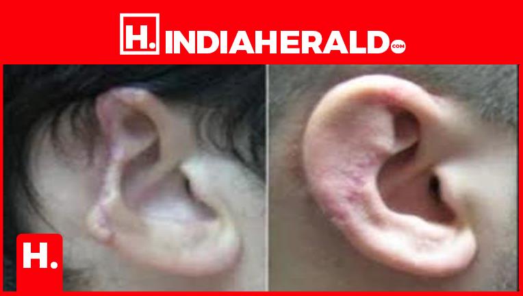 Preventing Ear Infections Through Healthy Habits.