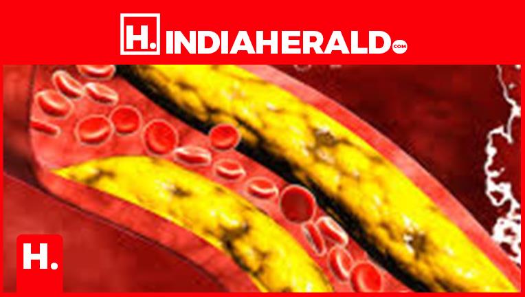 Understanding High Cholesterol During Pregnancy: Risks and