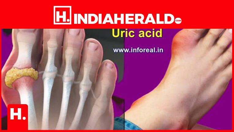Uric acid the cause of pain in your knees and ankles?