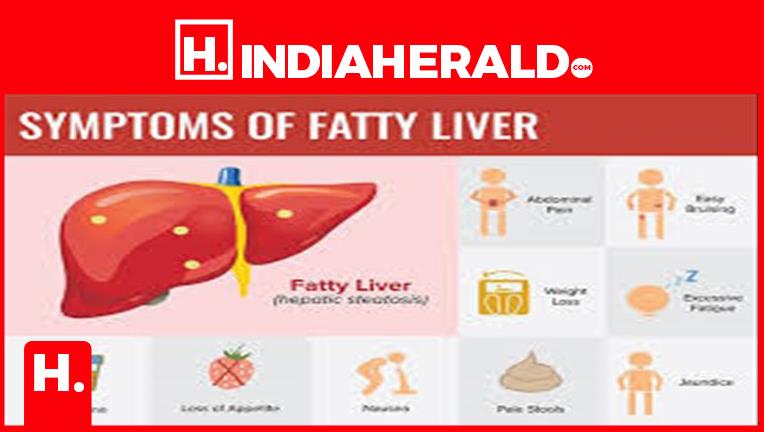 What are the symptoms of fatty liver?