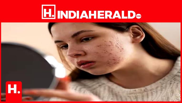 What causes the red dots on the body?