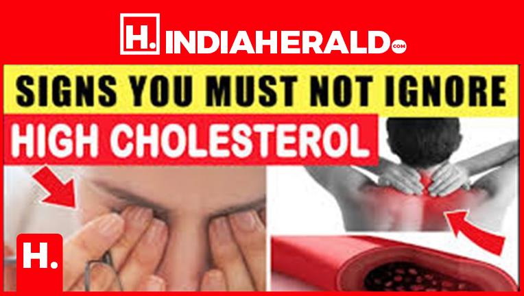 What happens when cholesterol levels are high???