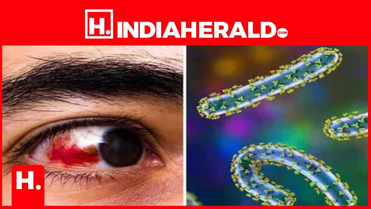 ముంచుకొస్తున్న ముప్పు... ప్రాణాంతకంగా మారుతున్న బ్లీడింగ్ ఐ