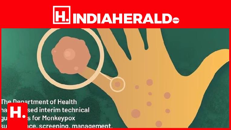 MonkeyPox symptoms develop, effects of infection