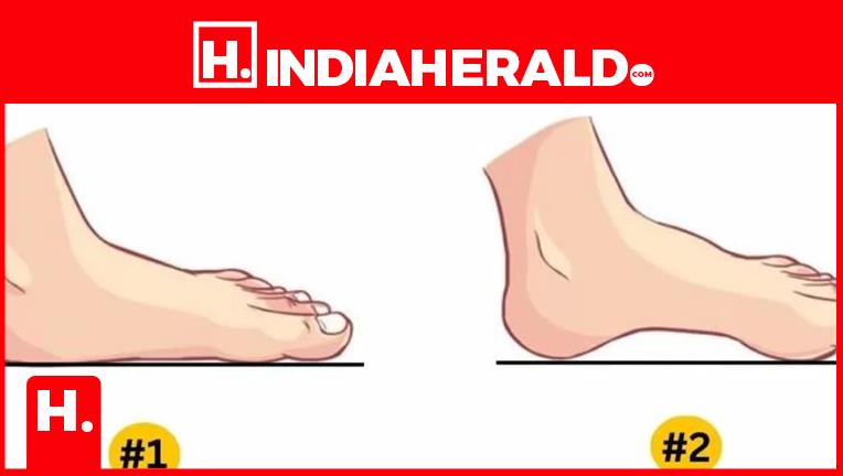 Your Foot Arch Well-Known Shows Your Hidden Character Devel