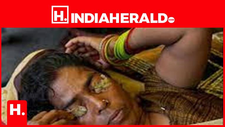 Eye Flu cases are constantly increasing from Delhi to Chhat