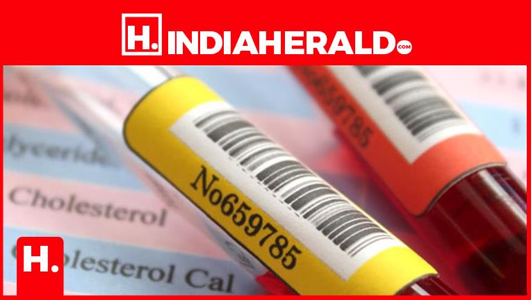 Improve Lipid Profile: Cholesterol that has accumulated in