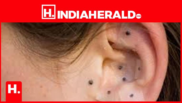 Science In The Back Of Ear Seeds: How Acupressure Can Impro